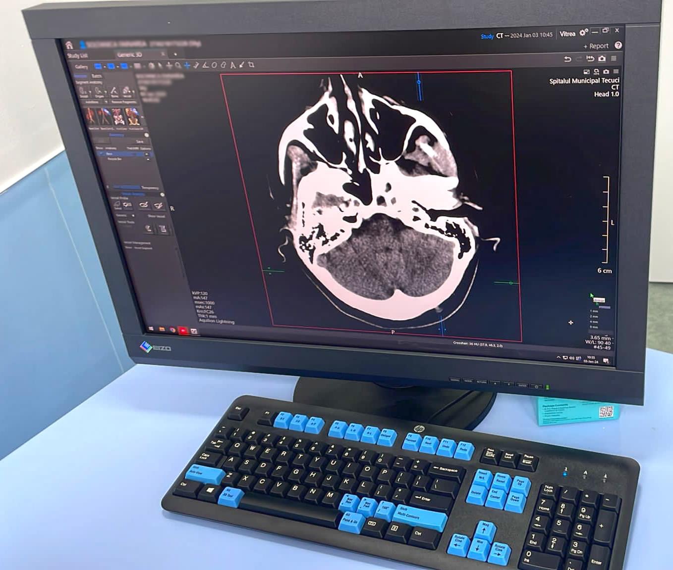 Primul pacient care a beneficiat gratuit de CT la Spitalul din Tecuci ...